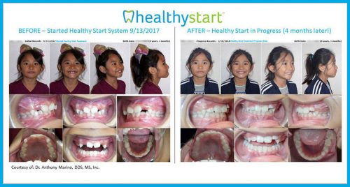 Healthy Start - Dental Solutions of South Florida - Leslie Haller